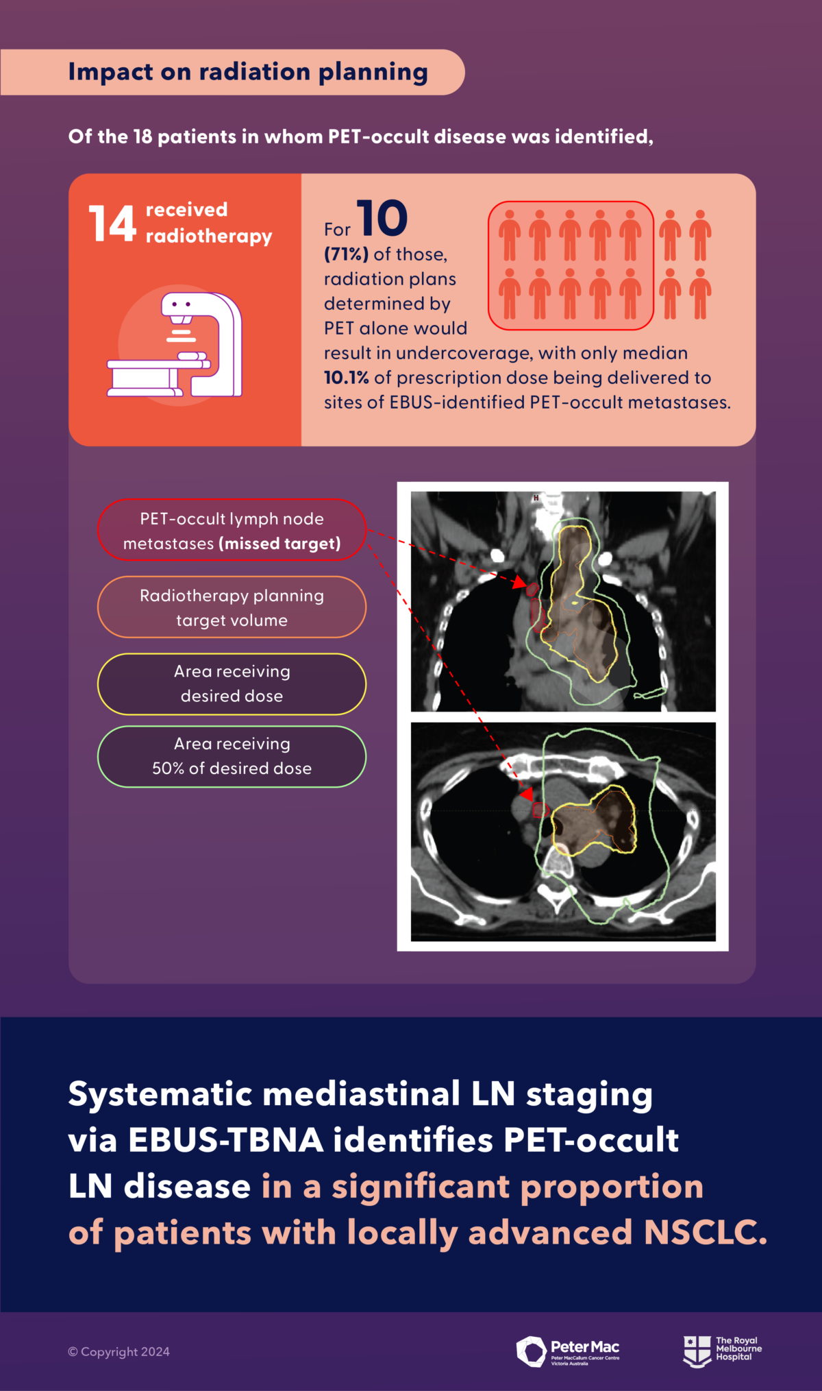 SEISMIC clinical trial infographic - Crealo Design